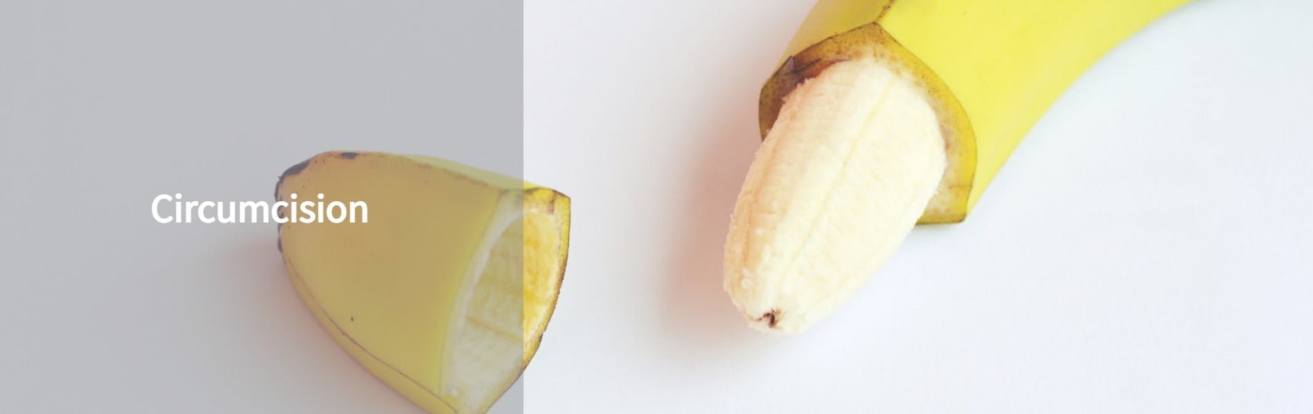 3 Types of Circumcision Surgery for Adults in Hong Kong